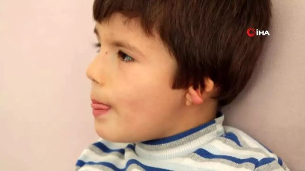 Aynaya bakınca kulaklarını kapatıyor - Haberler