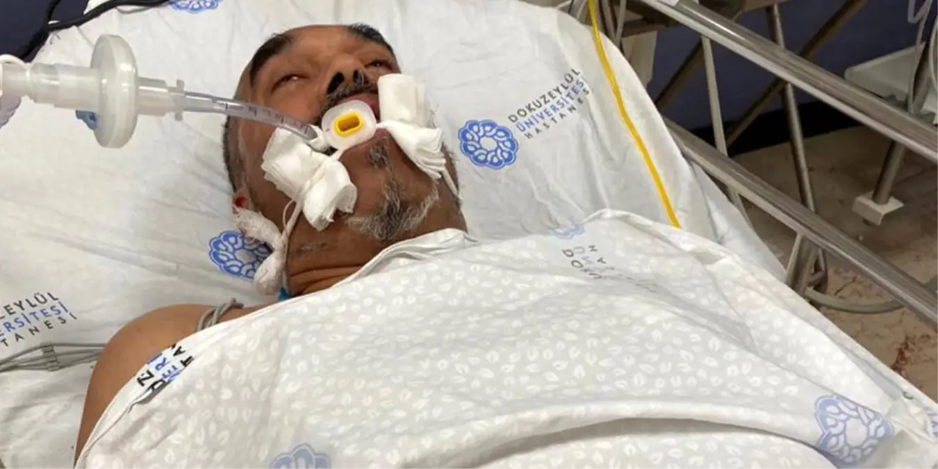 Müzisyen Tankut Alacalı Beyin Kanaması Geçirdi - Haberler