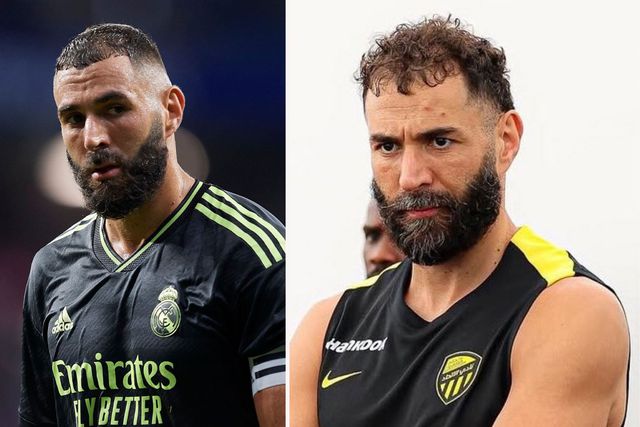 Benzema's latest appearance is surprising! He aged 10 years in Saudi ...